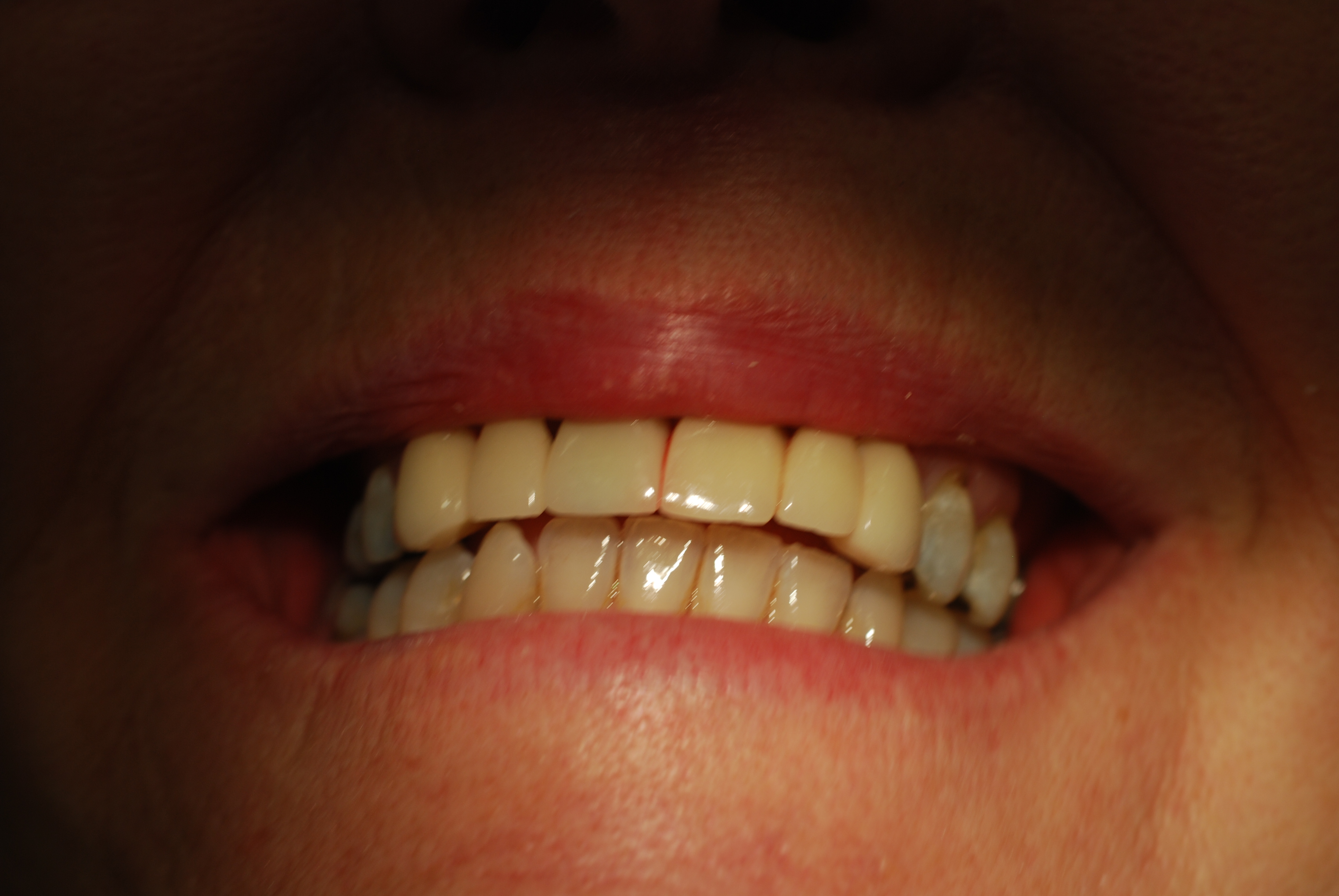 Before & After - Coxhoe Dental